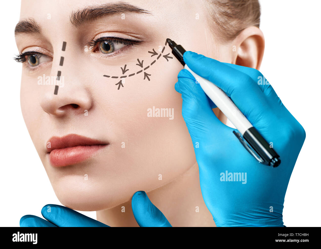 Woman plastic surgery face lines hi-res stock photography and images ...