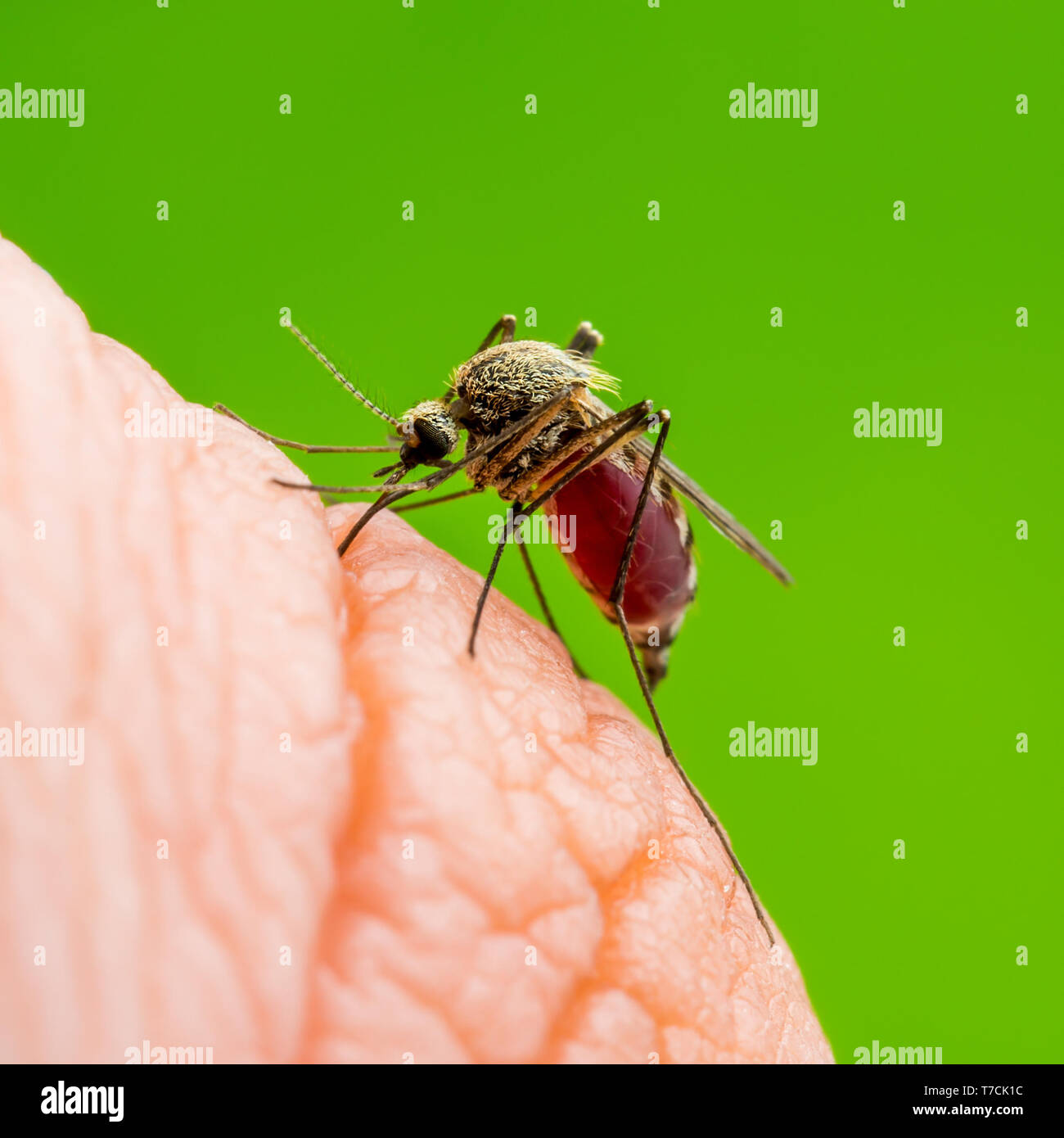 Encephalitis, Yellow Fever, Malaria Disease or Zika Virus Infected ...