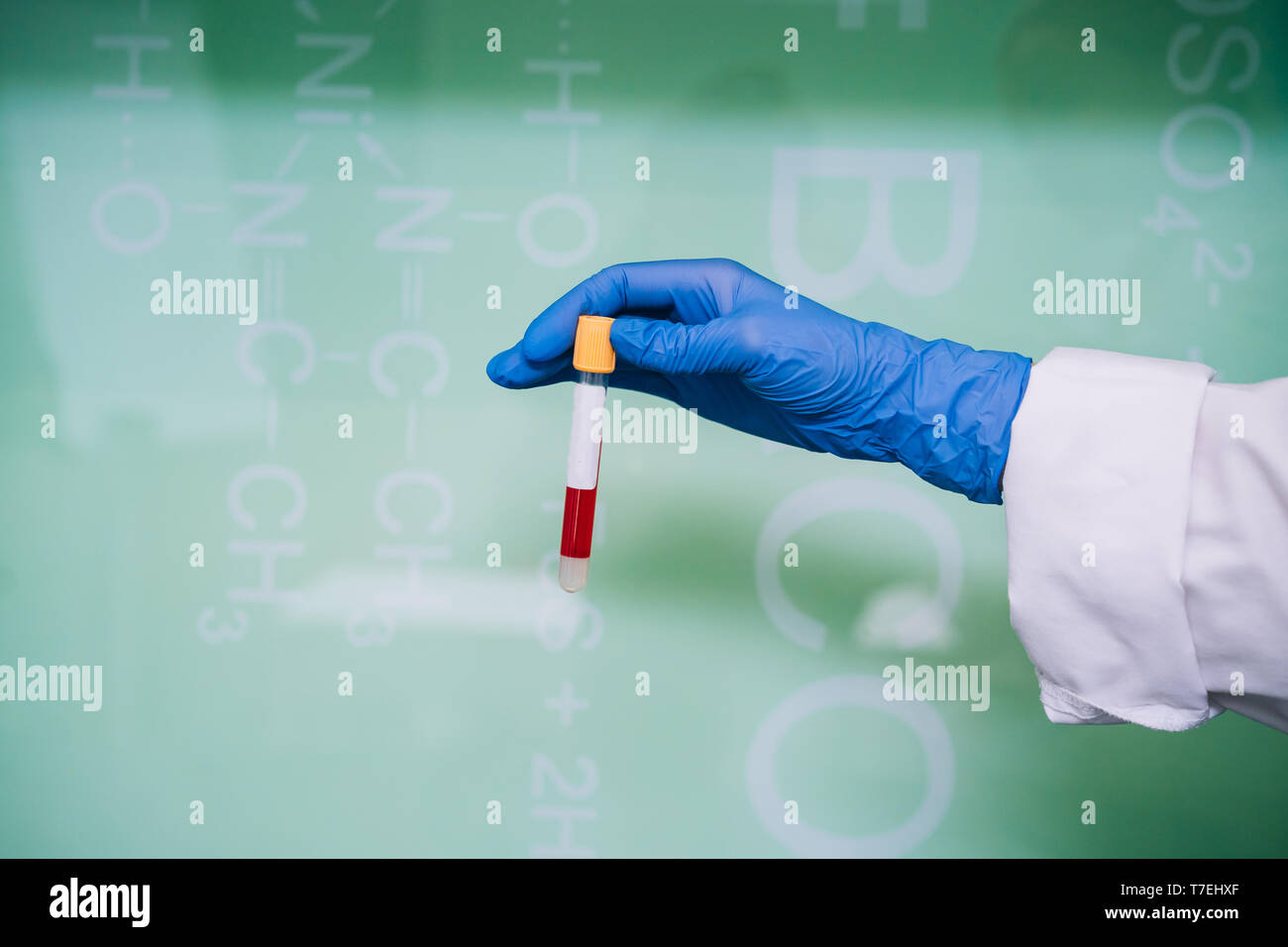 A rubber-gloved hand holds one test tube with the drug, close view ...