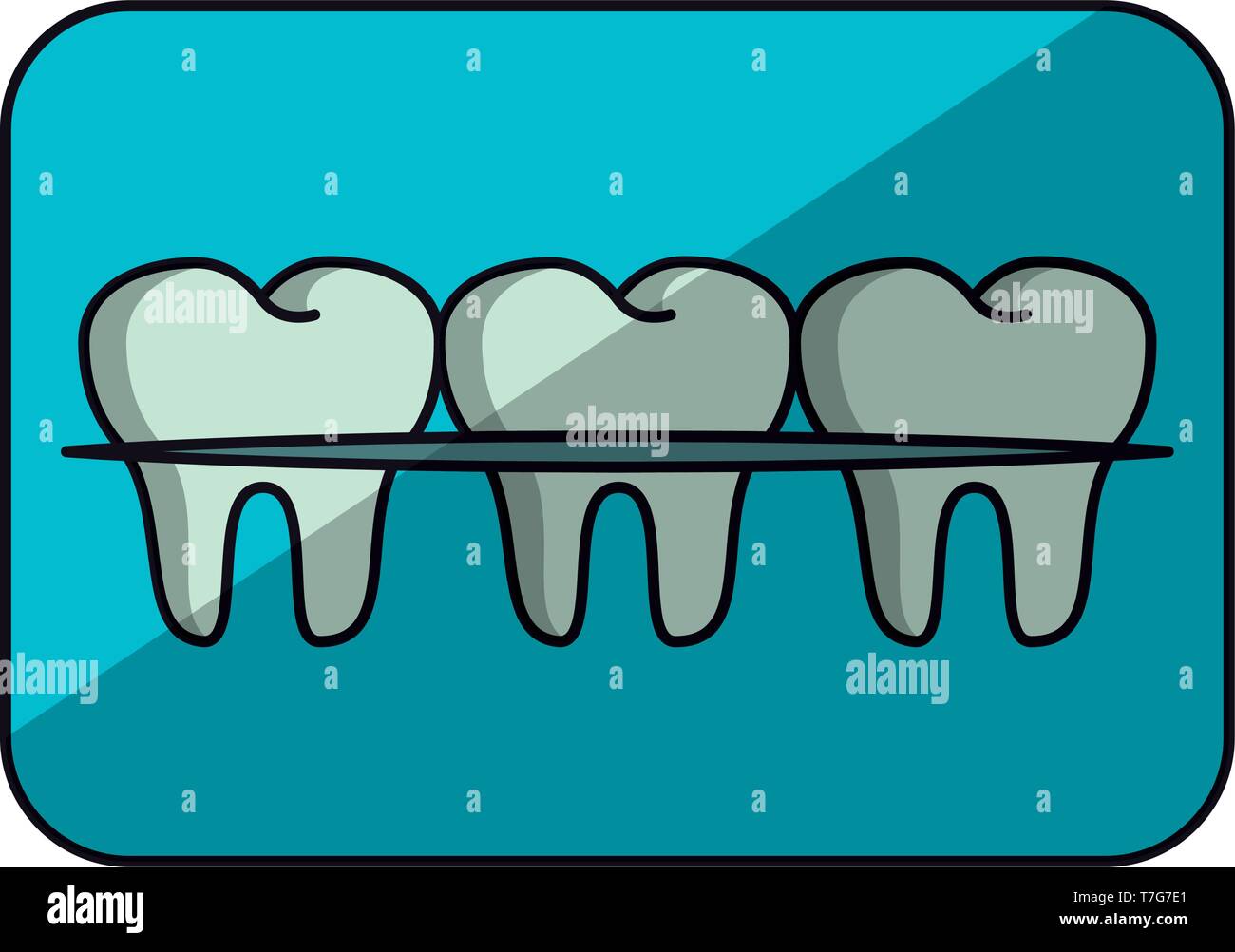Teeth with braces banner cartoon isolated Stock Vector Image & Art - Alamy