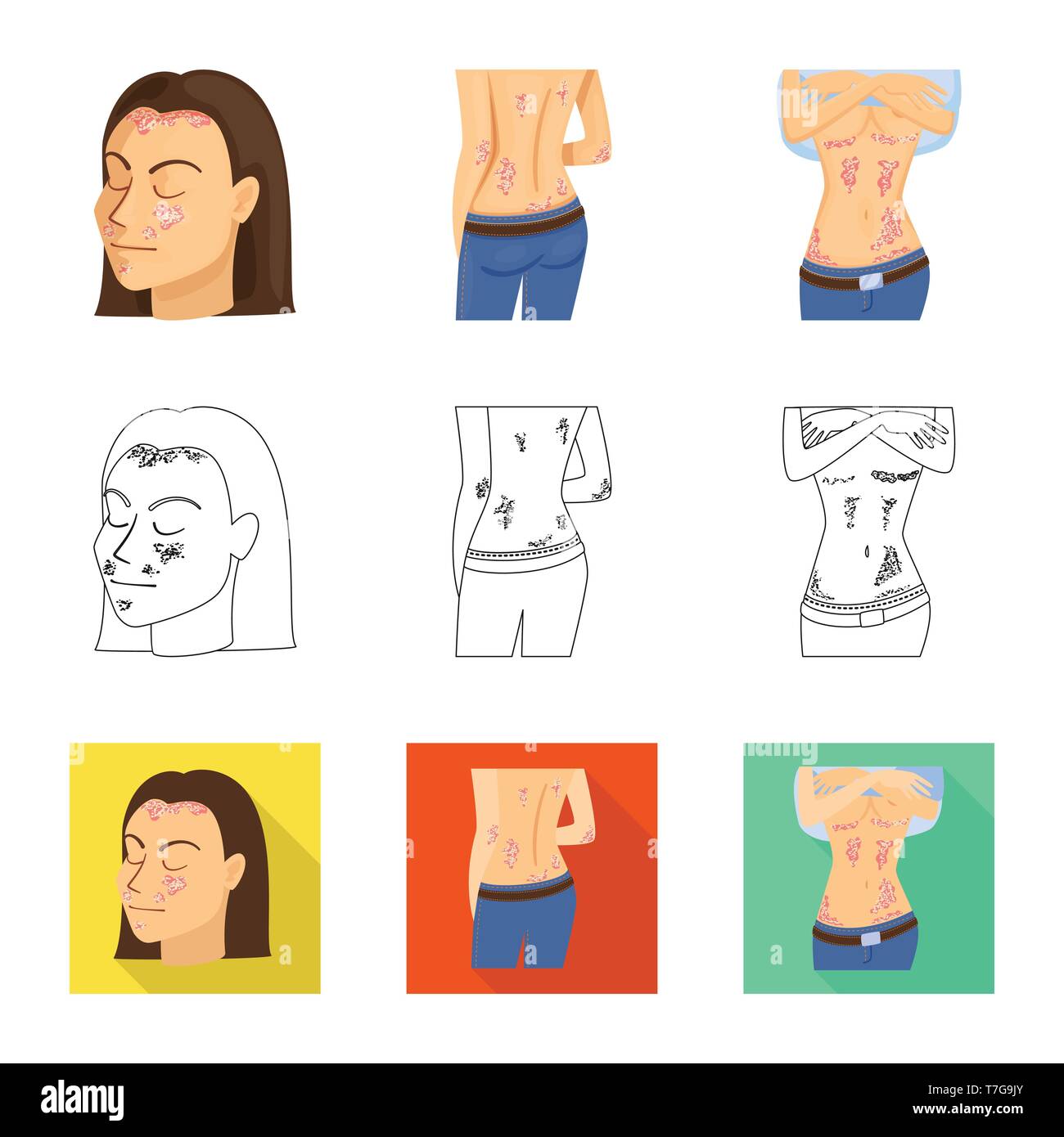 Chronic eczema Stock Vector Images - Alamy