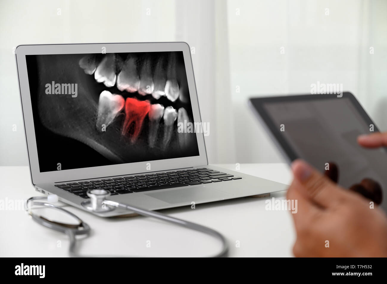 Dentist dental tool to teeth x-ray work Looking At Teeth X-ray On ...