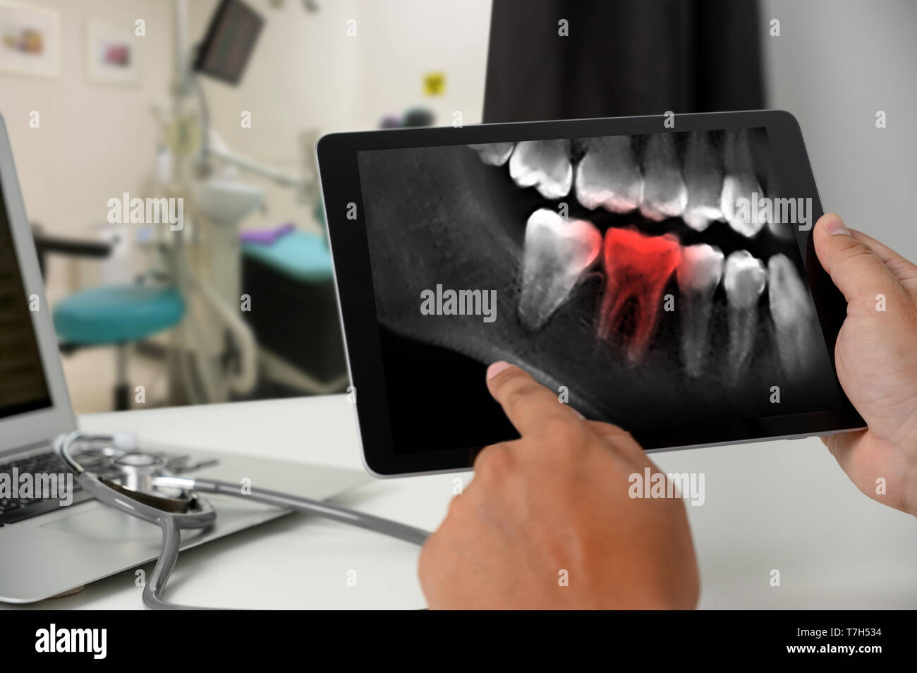 Dentist dental tool to teeth x-ray work Looking At Teeth X-ray On ...