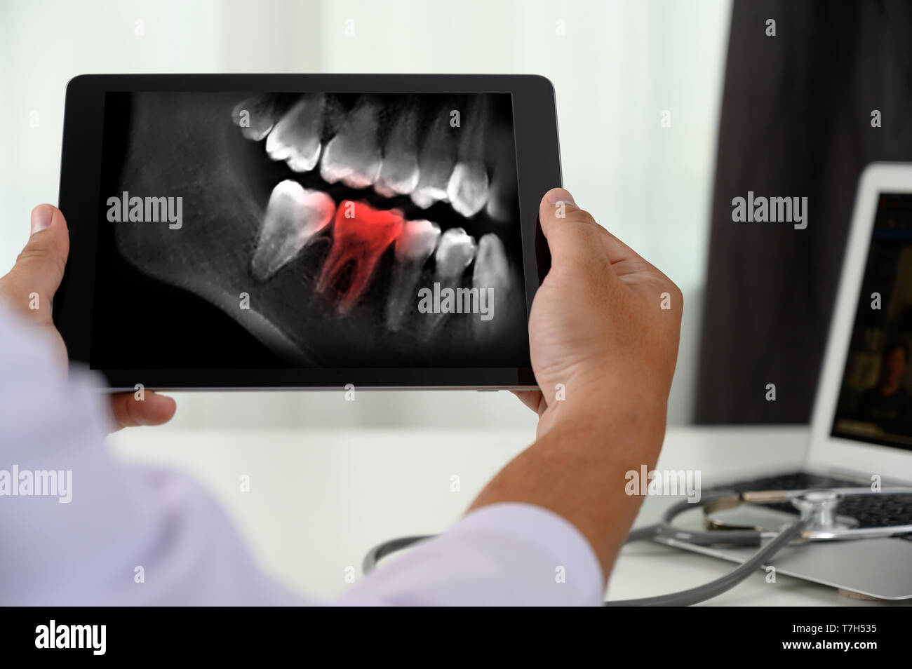 Dentist dental tool to teeth x-ray work Looking At Teeth X-ray On ...