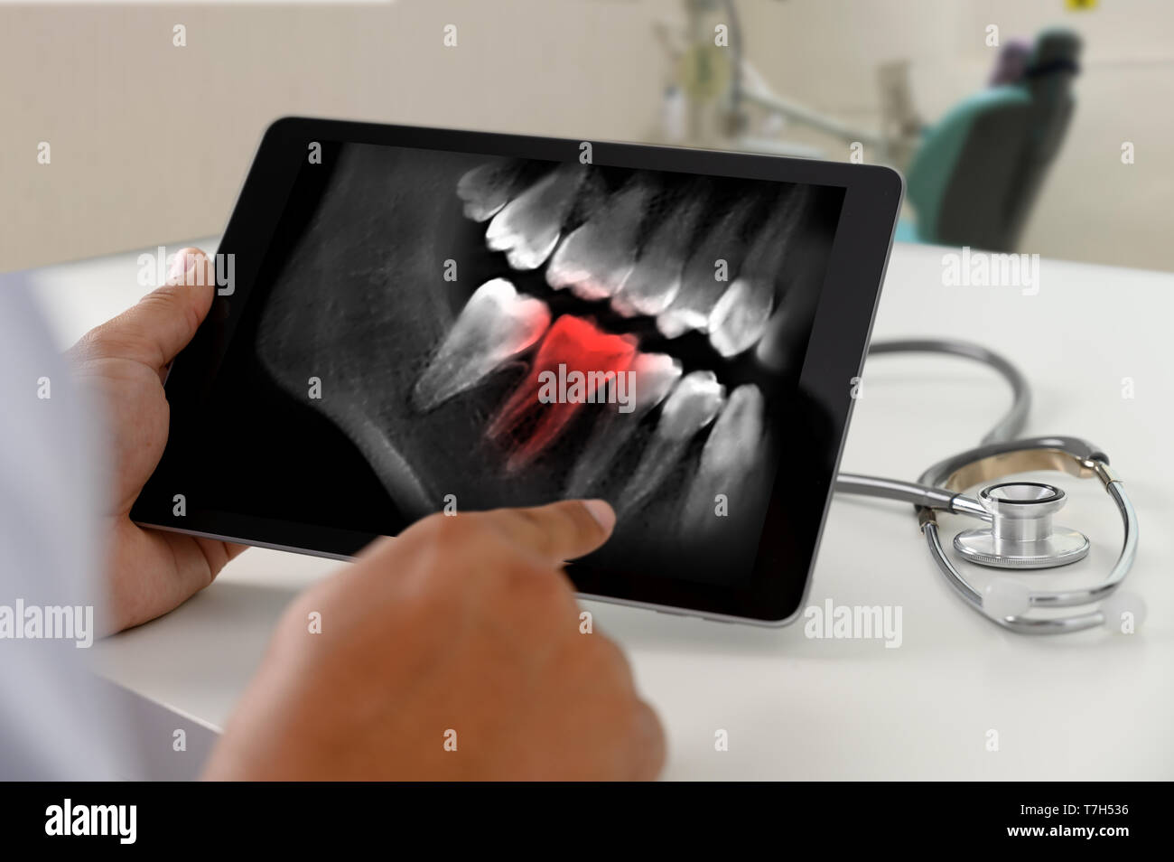 Dentist dental tool to teeth x-ray work Looking At Teeth X-ray On ...