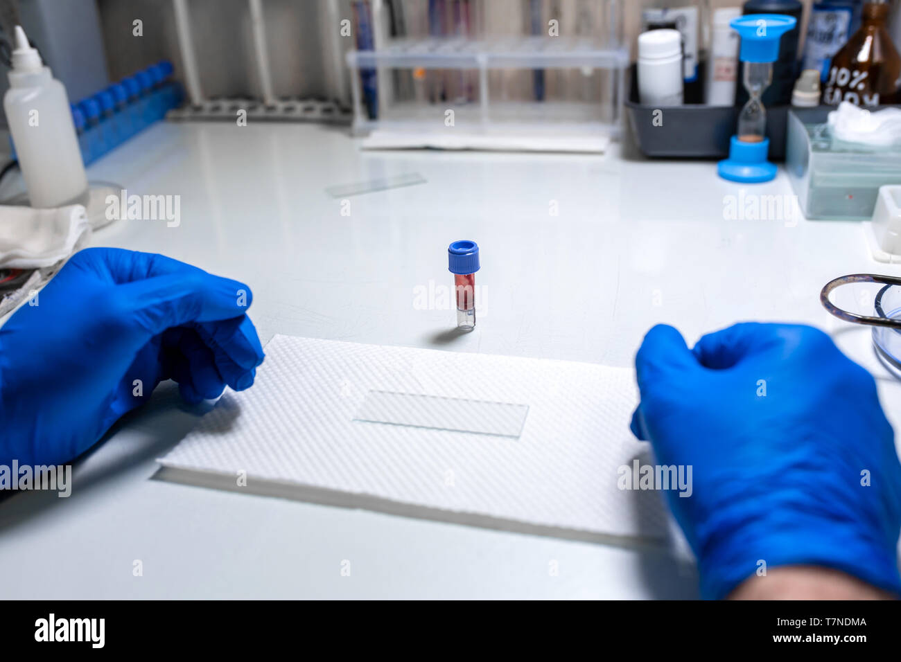 scientist prepare blood sample for research on microscope. Placing ...