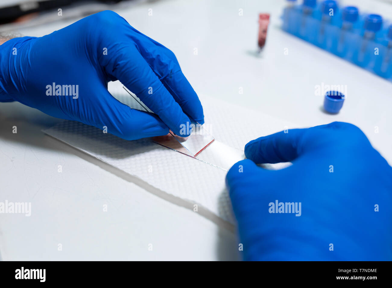 scientist prepare blood sample for research on microscope. Placing ...
