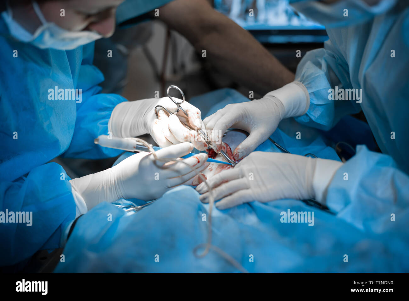 Bloody surgical glove hi-res stock photography and images - Alamy