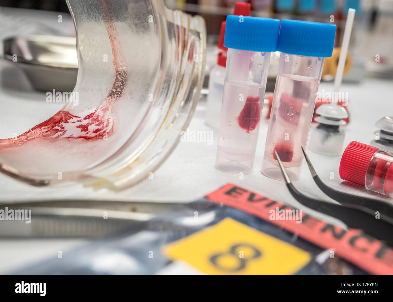 Swabs with blood sample to be analyzed in the laboratory, conceptual ...
