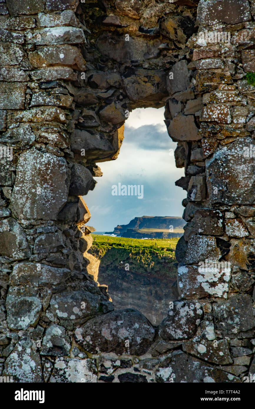 Dunlace Castle, County Antrim, Northern Ireland Stock Photo - Alamy