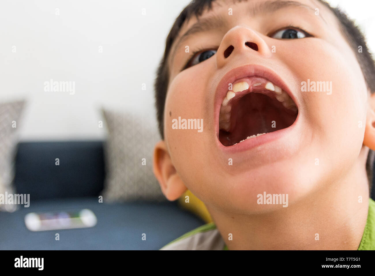 Missing jaw hi-res stock photography and images - Alamy