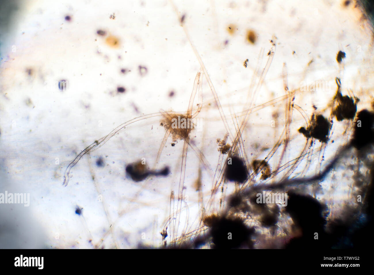 Aspergillus microscope hi-res stock photography and images - Alamy