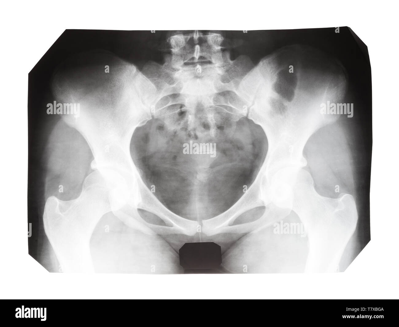 Female Pelvis Stock Photos & Female Pelvis Stock Images - Alamy