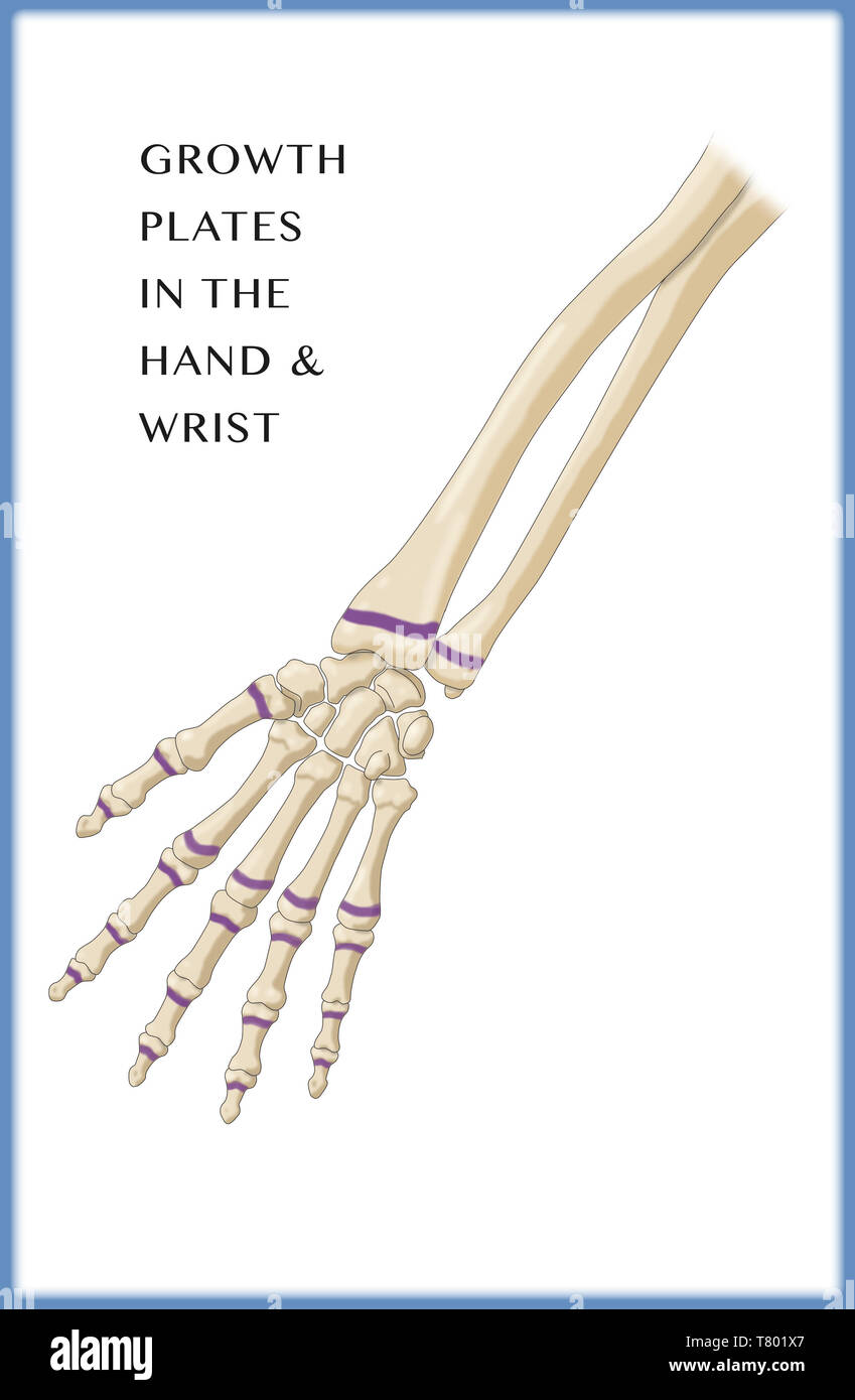 Hand Growth Plates, Illustration Stock Photo - Alamy