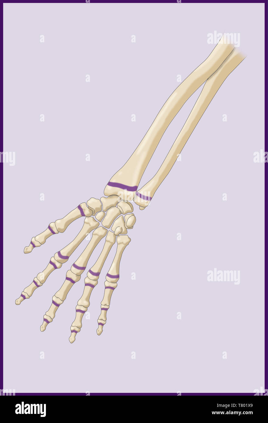 Hand Growth Plates, Illustration Stock Photo - Alamy