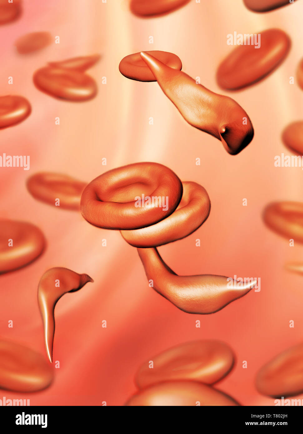 Sickle Cells, Illustration Stock Photo - Alamy
