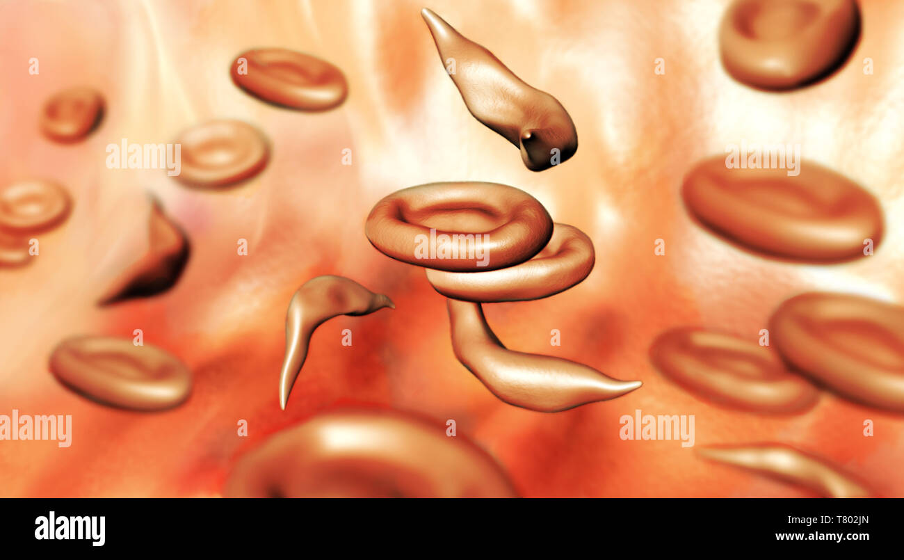 Sickle Cells, Illustration Stock Photo - Alamy