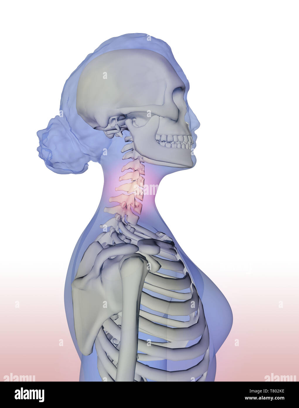 Neck pain illustration hi-res stock photography and images - Alamy