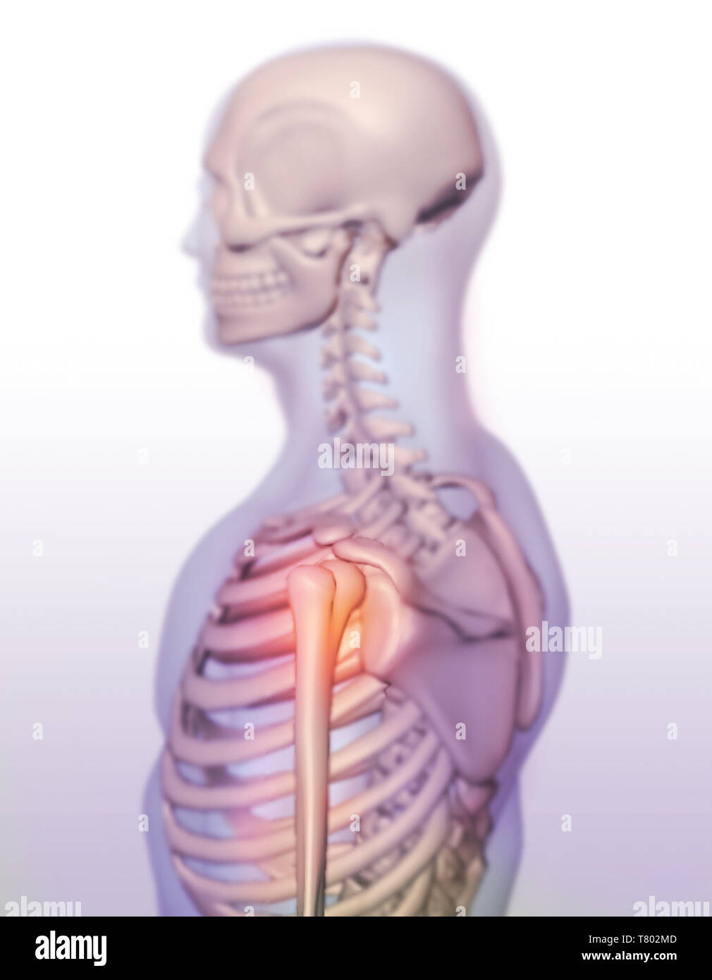 Shoulder Pain, Illustration Stock Photo - Alamy