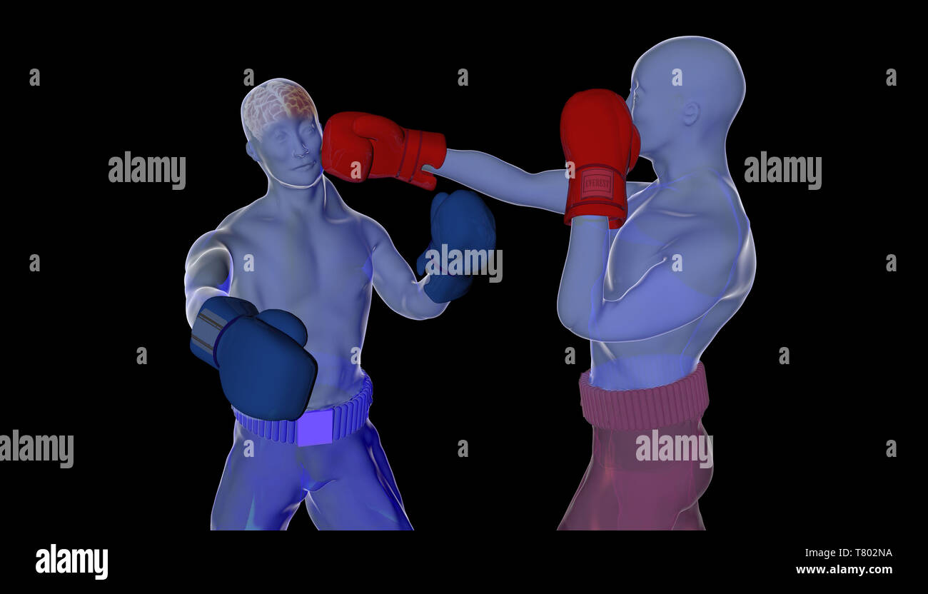 Blunt trauma hi-res stock photography and images - Alamy