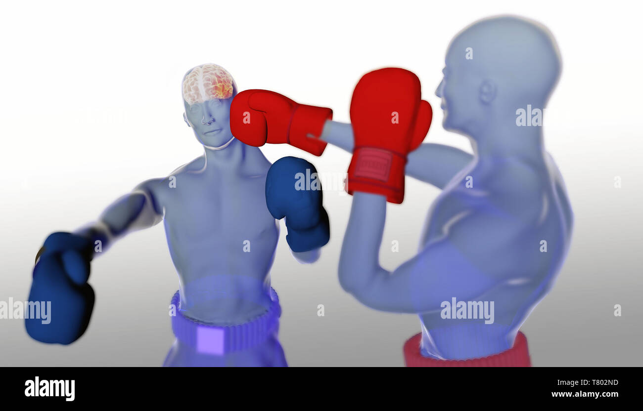 Blunt trauma hi-res stock photography and images - Alamy