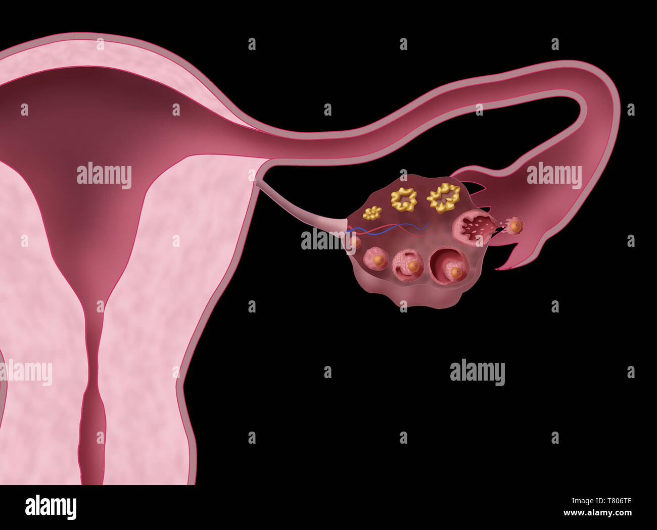 Uterus diagram hi-res stock photography and images - Alamy