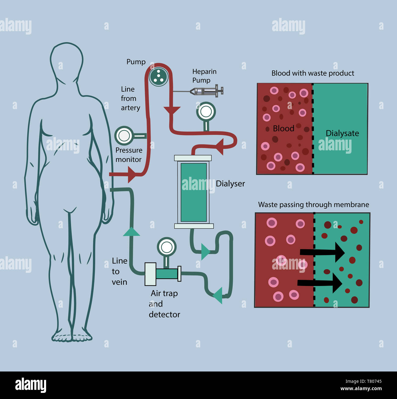 Hemodialysis Machine Animation