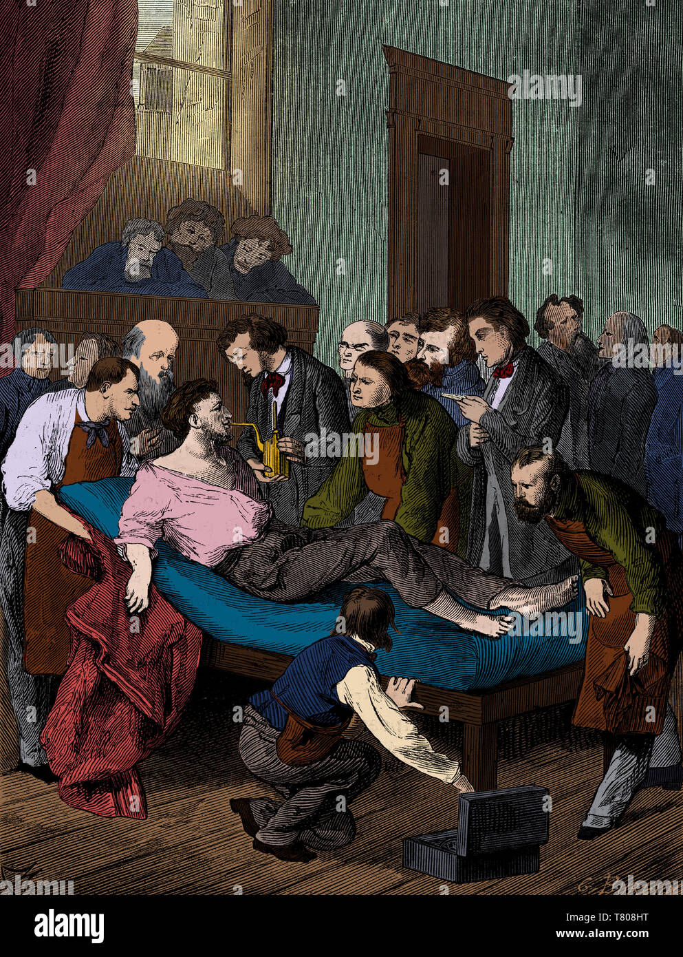 Ether anesthesia hi-res stock photography and images - Alamy