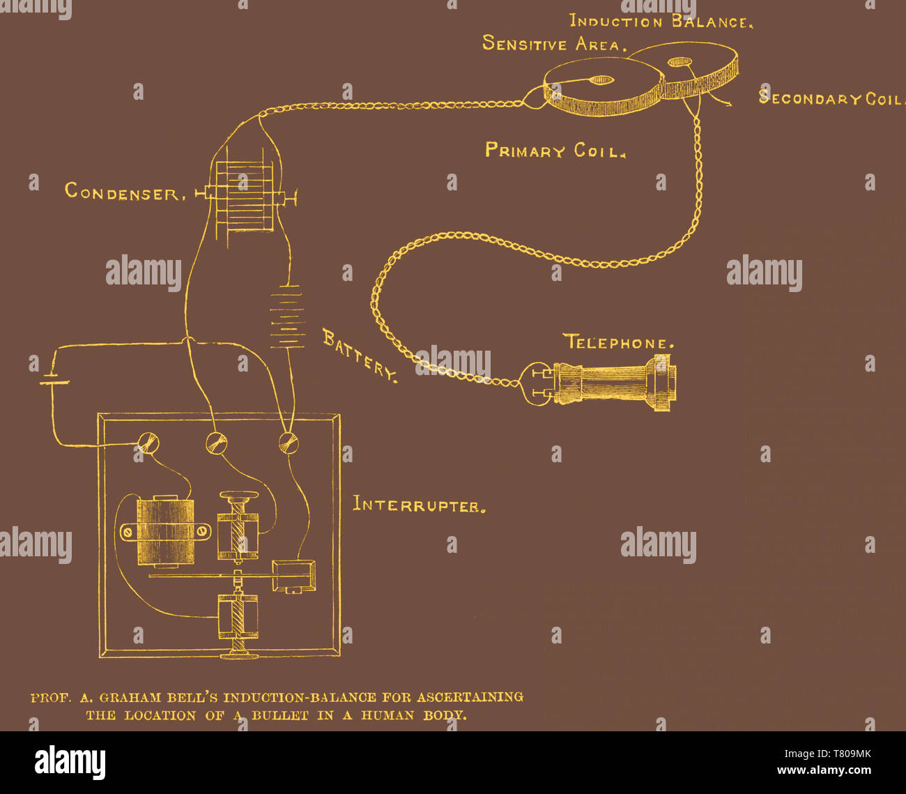 Alexander Graham Bell, Metal Detector, 1891 Stock Photo - Alamy