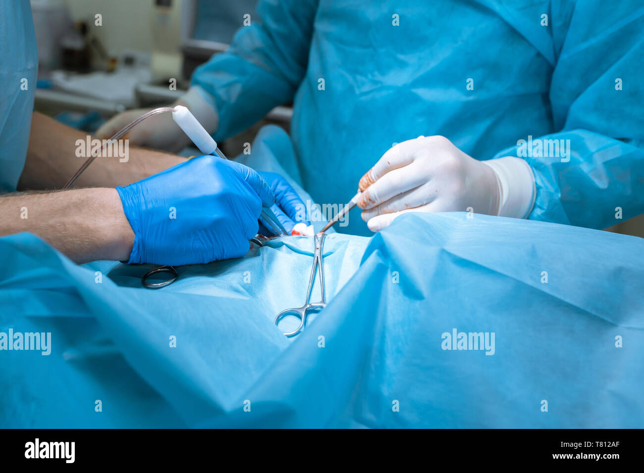 the surgeon applies a surgical clamp to stop the bleeding. Group of ...