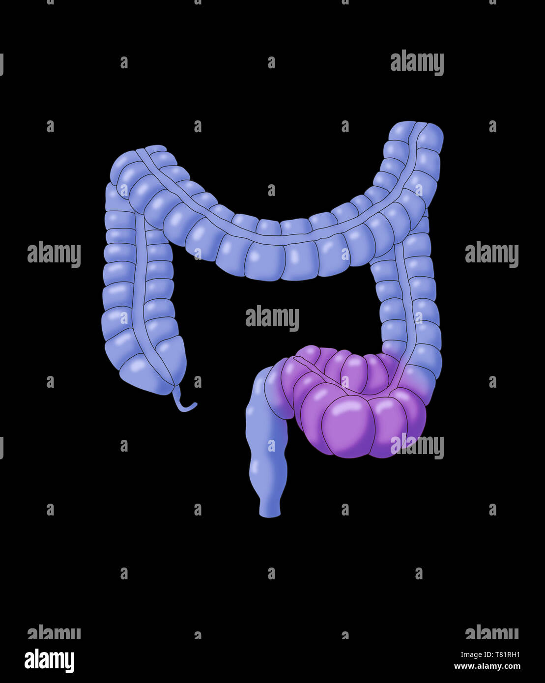 Constipated Colon, Illustration Stock Photo - Alamy