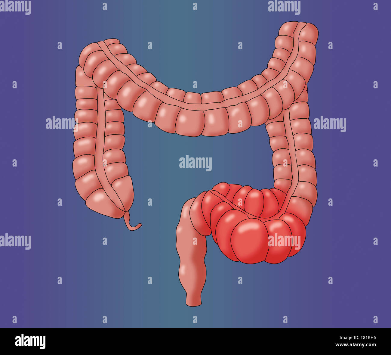 Constipated hi-res stock photography and images - Alamy