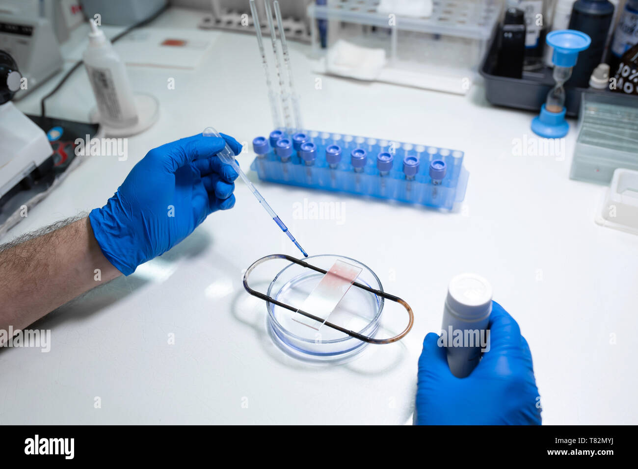 scientist prepare blood sample for research on microscope. Placing ...