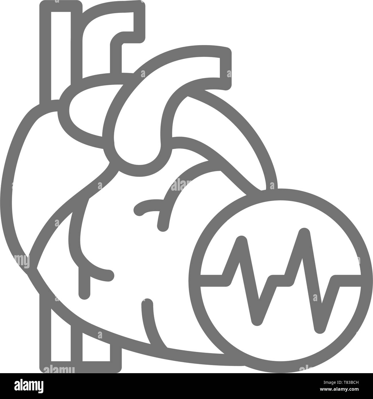 Visceral fat hi-res stock photography and images - Alamy