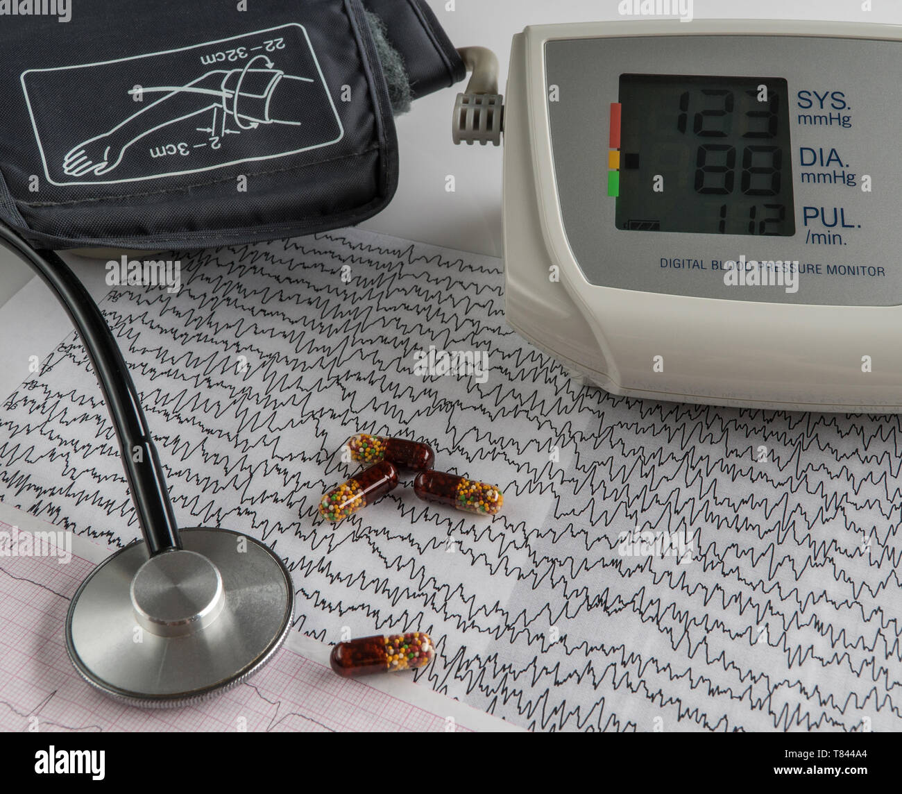 modern electric tonometer and a stethoscope on a cardiogram chart ...
