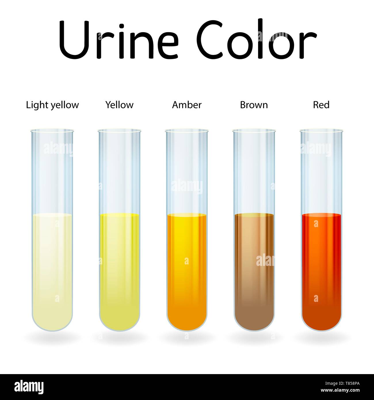 Urinary colour, illustration Stock Photo - Alamy