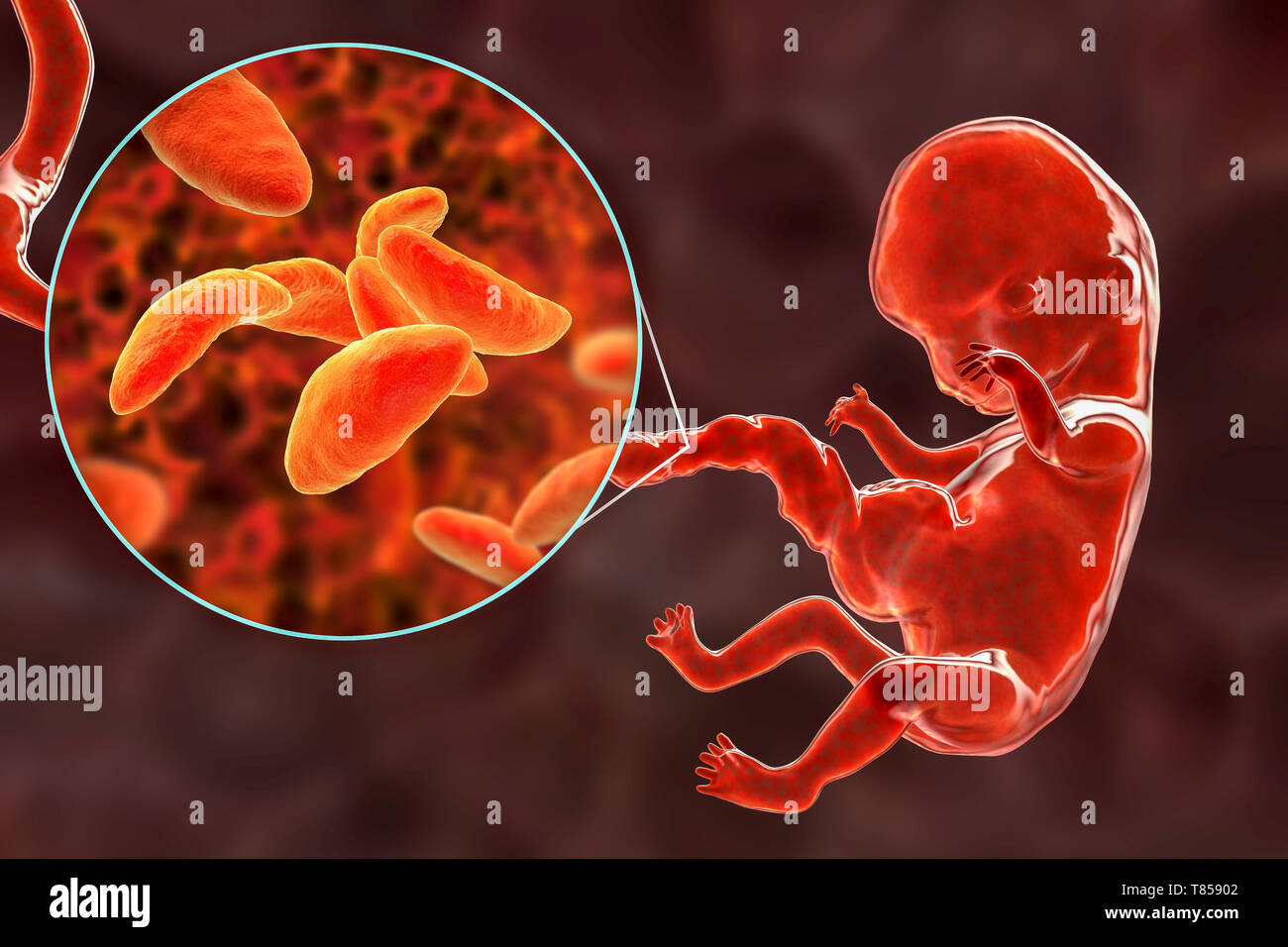 Transplacental transmission of Toxoplasmosis, illustration Stock Photo ...