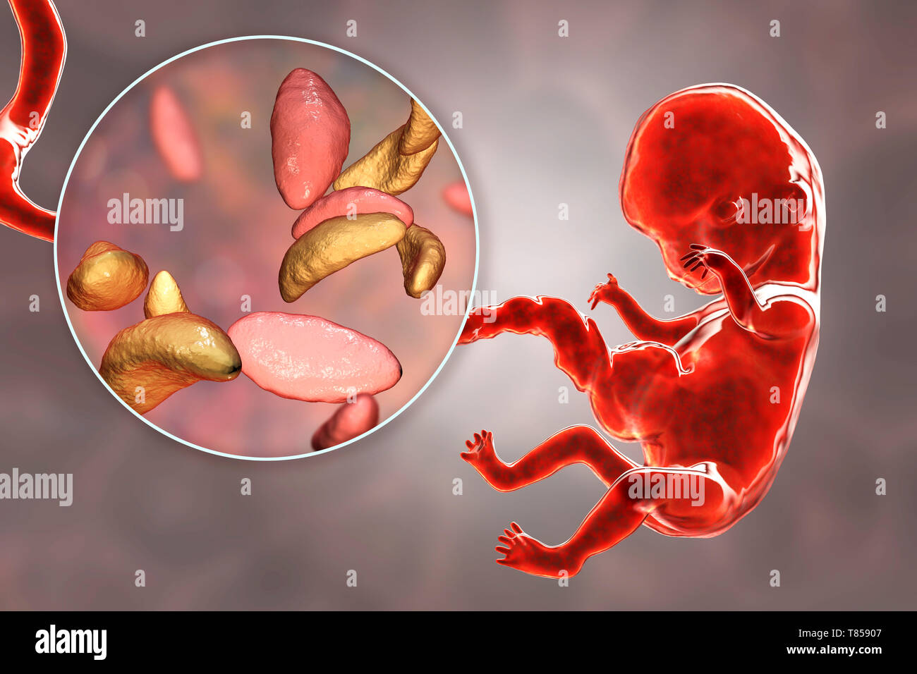 Transplacental transmission of Toxoplasmosis, illustration Stock Photo ...
