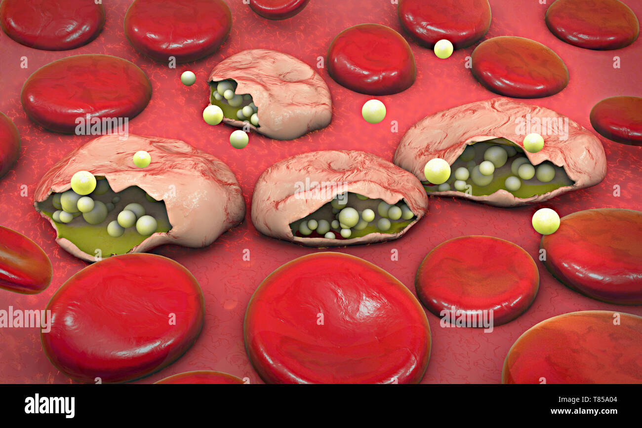 Malaria parasite hi-res stock photography and images - Alamy