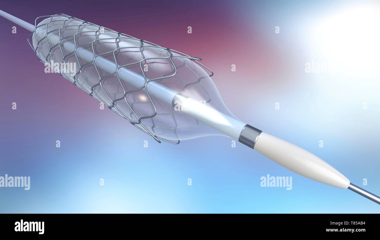 Coronary stent hi-res stock photography and images - Alamy
