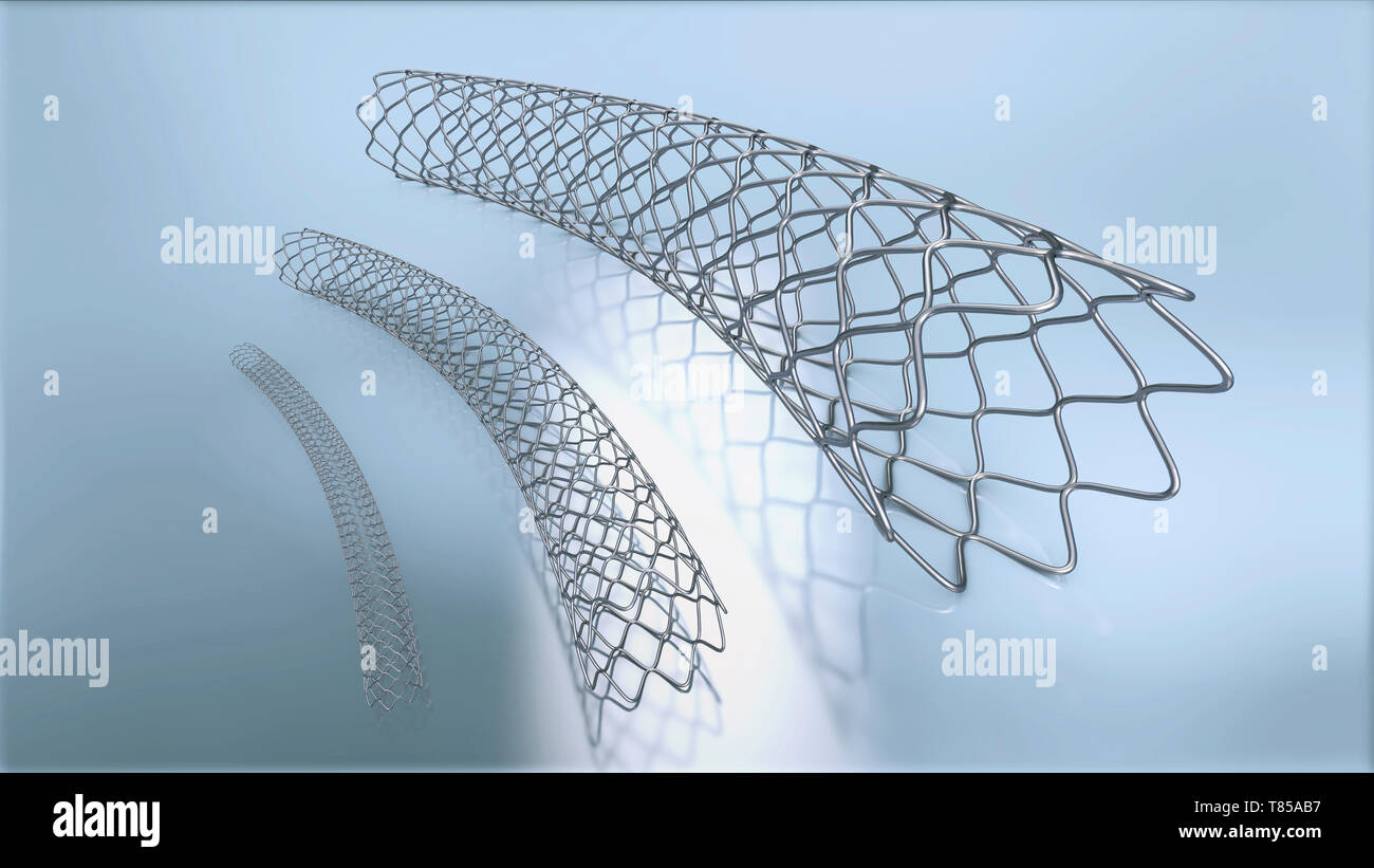 Coronary stent hi-res stock photography and images - Alamy
