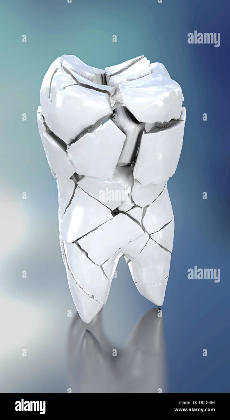 Broken tooth hi-res stock photography and images - Alamy