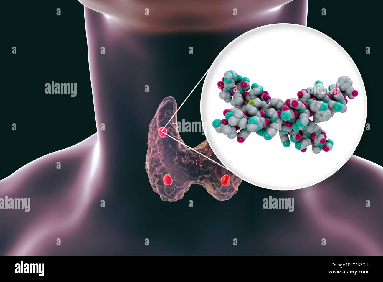 Parathyroid glands and parathyroid hormone, illustration Stock Photo ...