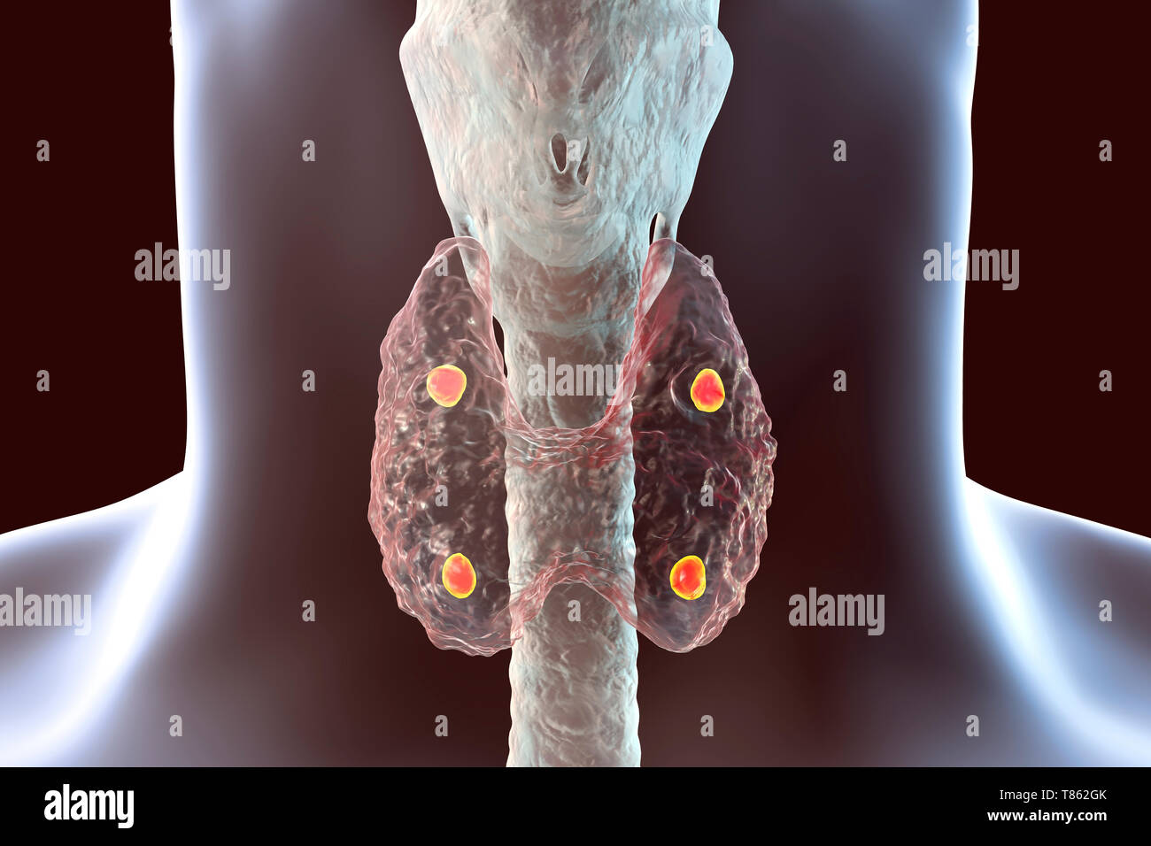 Parathyroid Stock Photos & Parathyroid Stock Images - Alamy