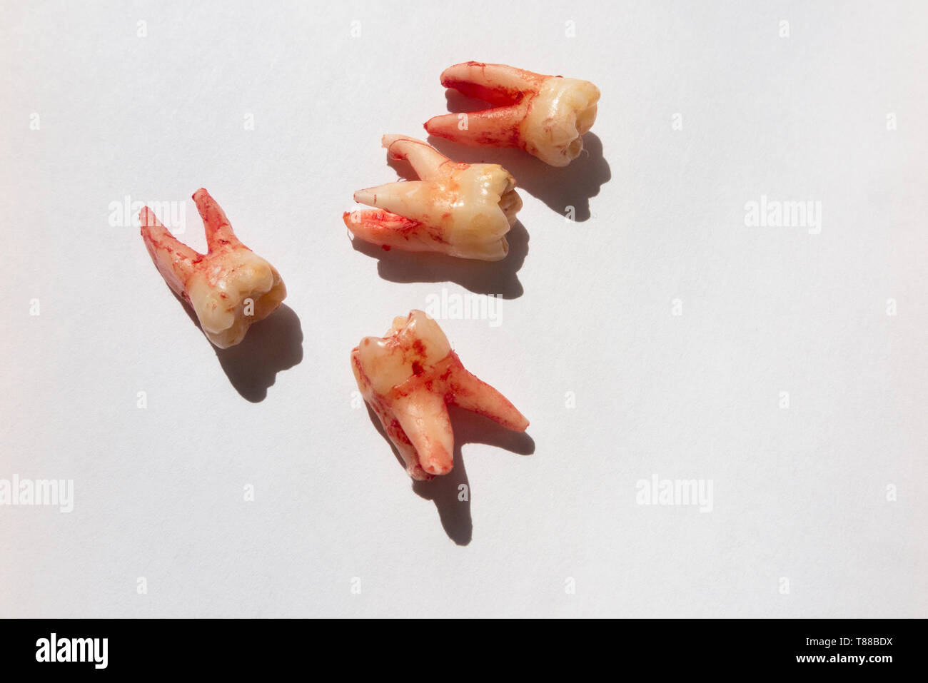 Upper And Lower Teeth High Resolution Stock Photography and Images - Alamy