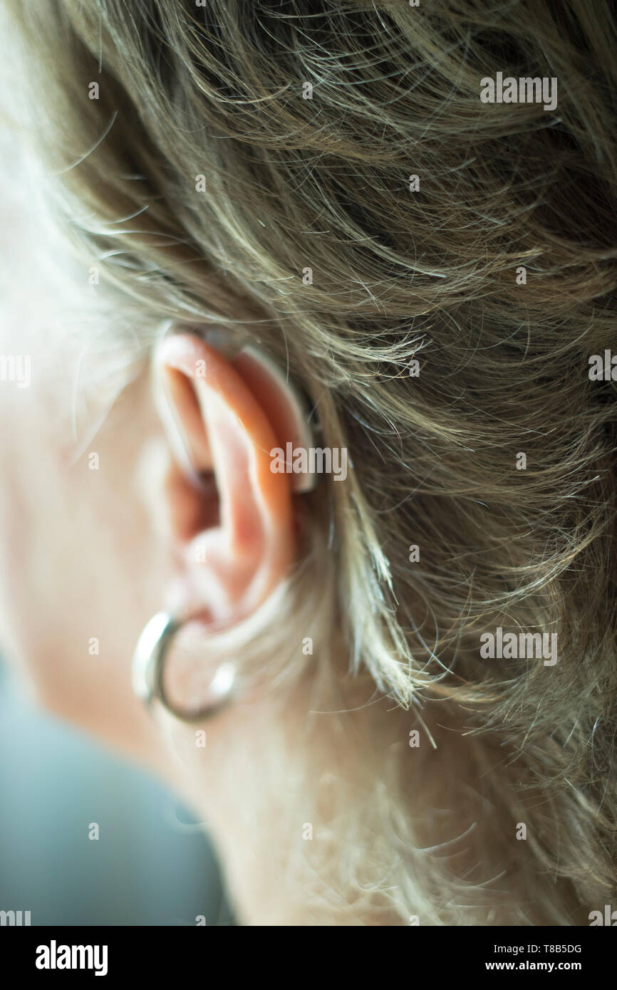 Deaf lady with modern technology digital hearing aid in her ear Stock ...
