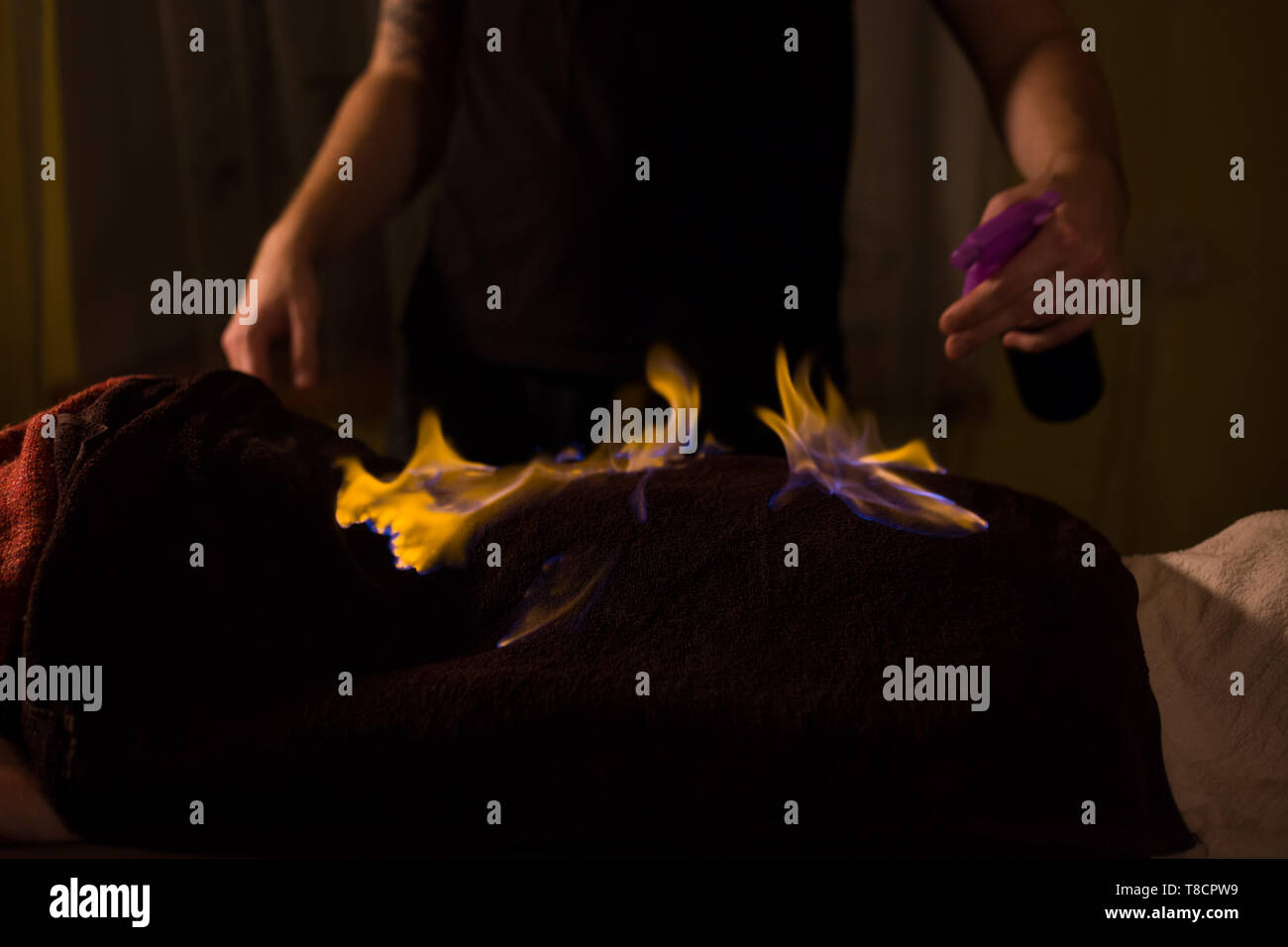 Chinese fire massage - Huo Liao therapy. Traditional chinese medicine ...