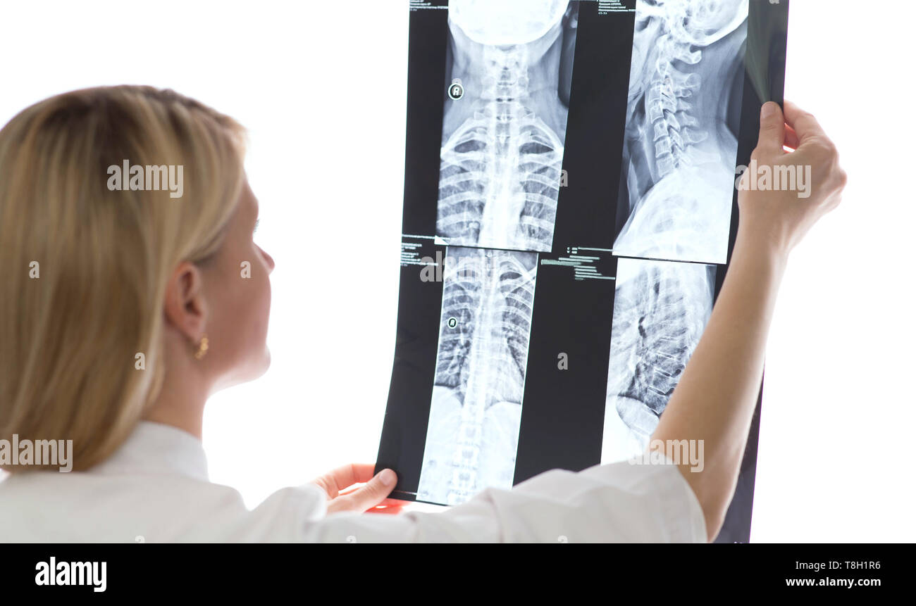doctor examining patients x-ray and MRI scans Stock Photo - Alamy