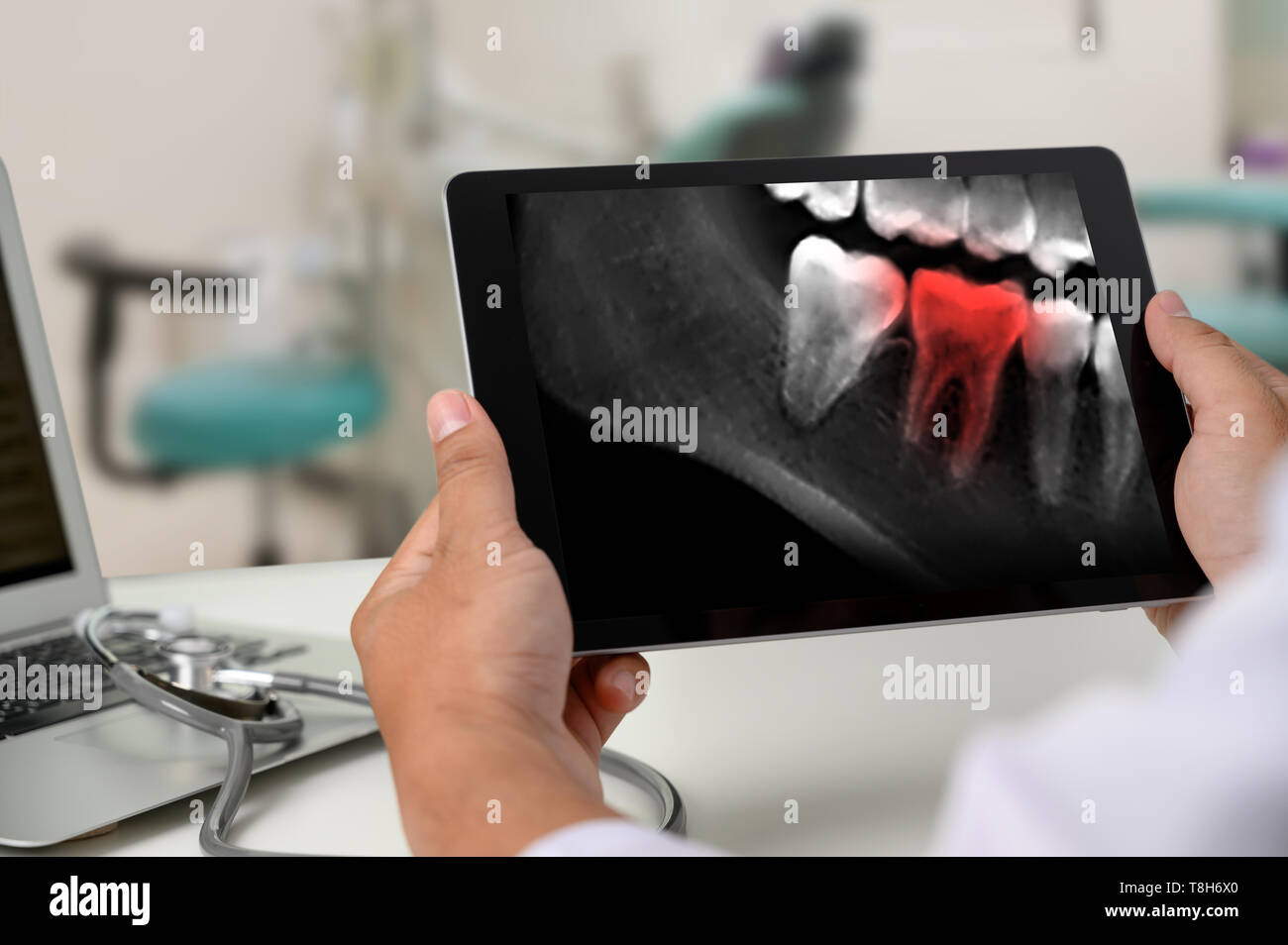 Dentist dental tool to teeth x-ray work Looking At Teeth X-ray On ...