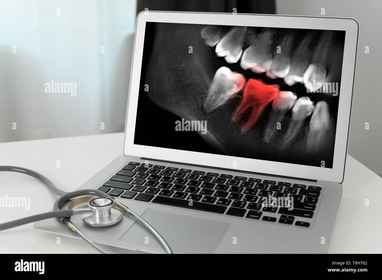 Dentist dental tool to teeth x-ray work Looking At Teeth X-ray On ...